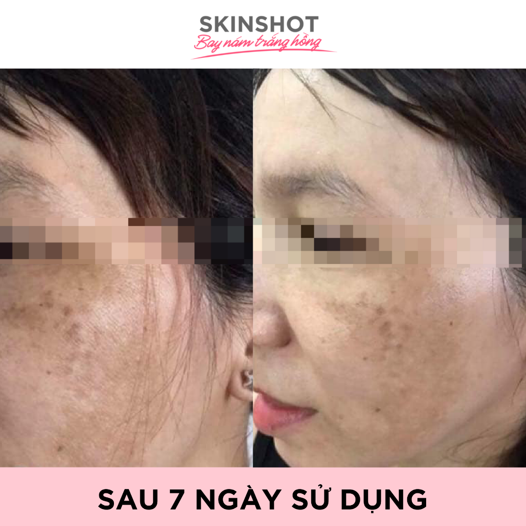 Nguồn collagen peptides trong SkinShot dưới góc nhìn của chuyên gia ...